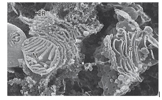 Endoplasmic Reticulum (Rough And Smooth) ER | Biology